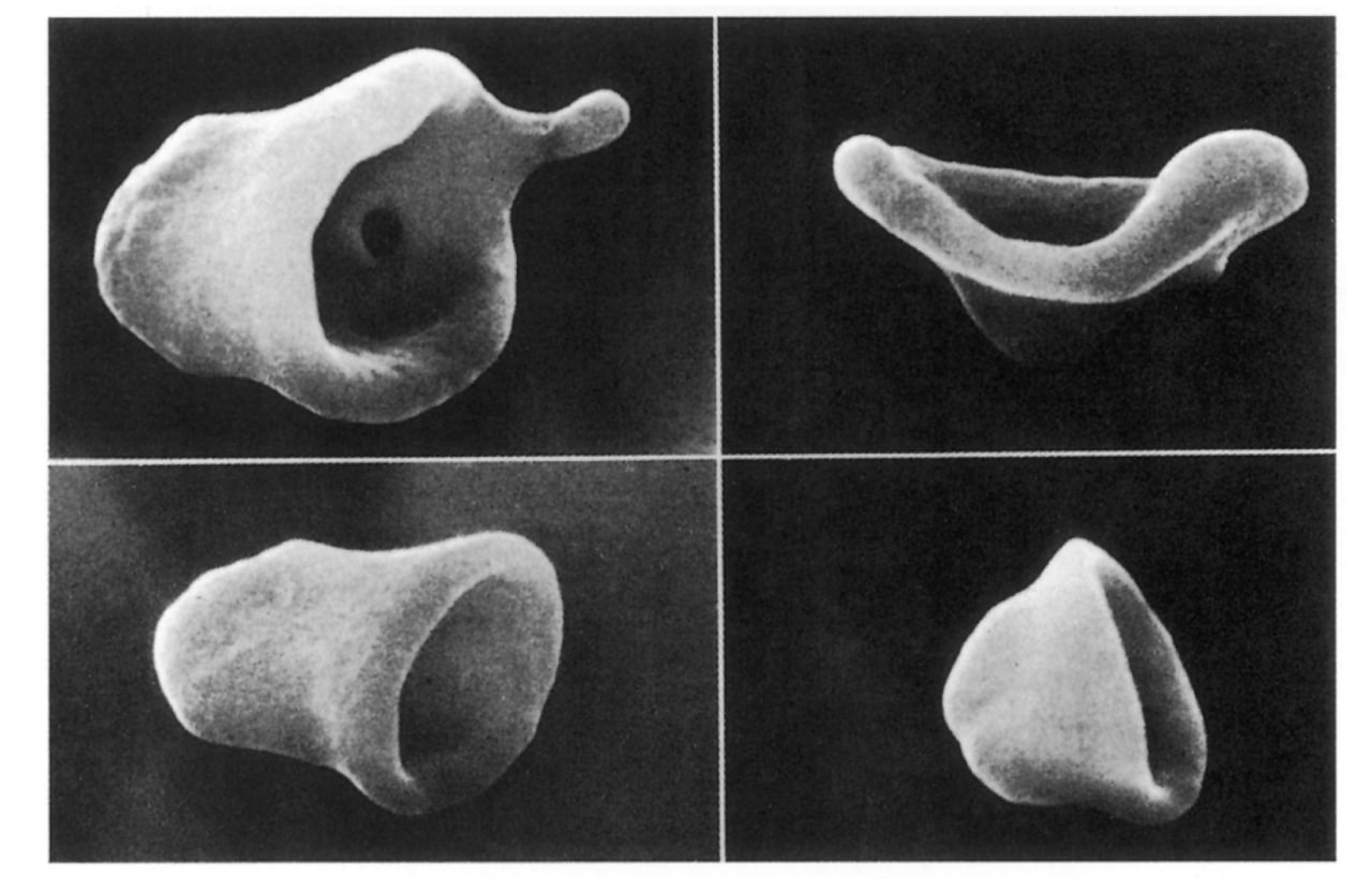 ریچارد آشر – وقتی هماتولوژیست از هماتولوژیست شاکی است – مدرسه پزشکی
